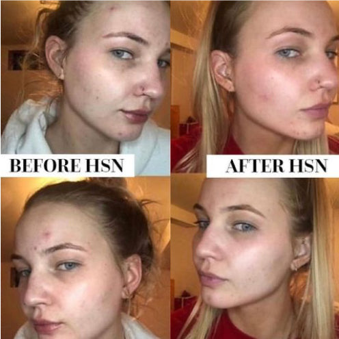 Real Results – Halo Beauty